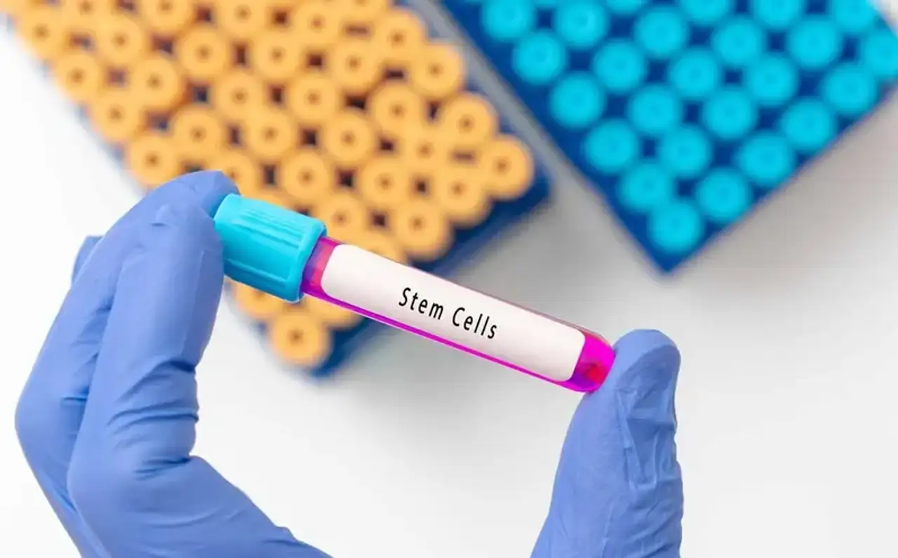 Therapeutic angiogenesis using stem cell