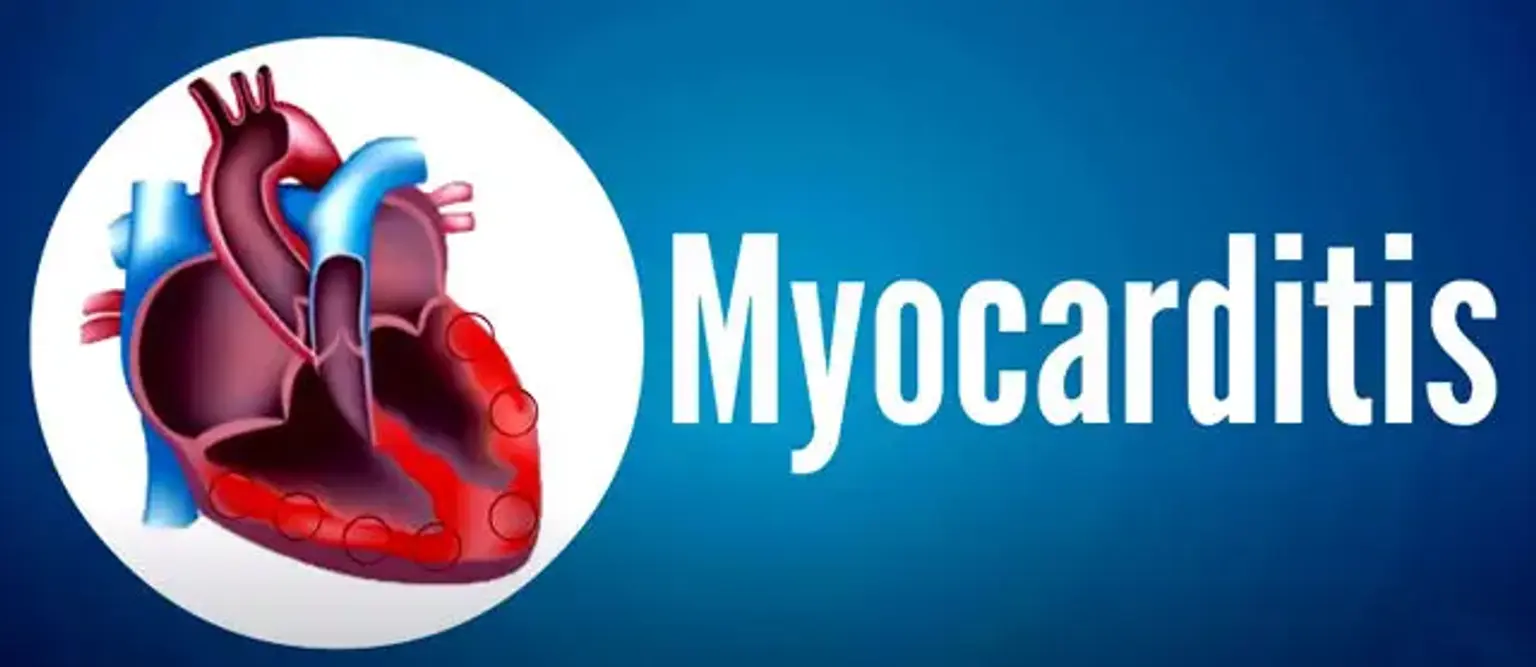 Myocarditis Diagnosis and Care