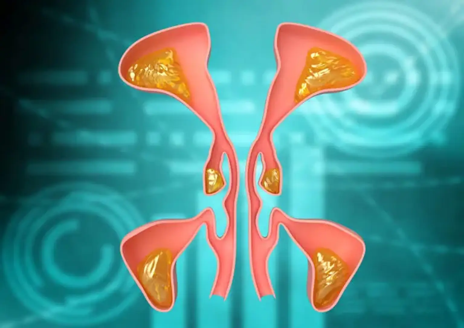 Sphenoiditis Treatment