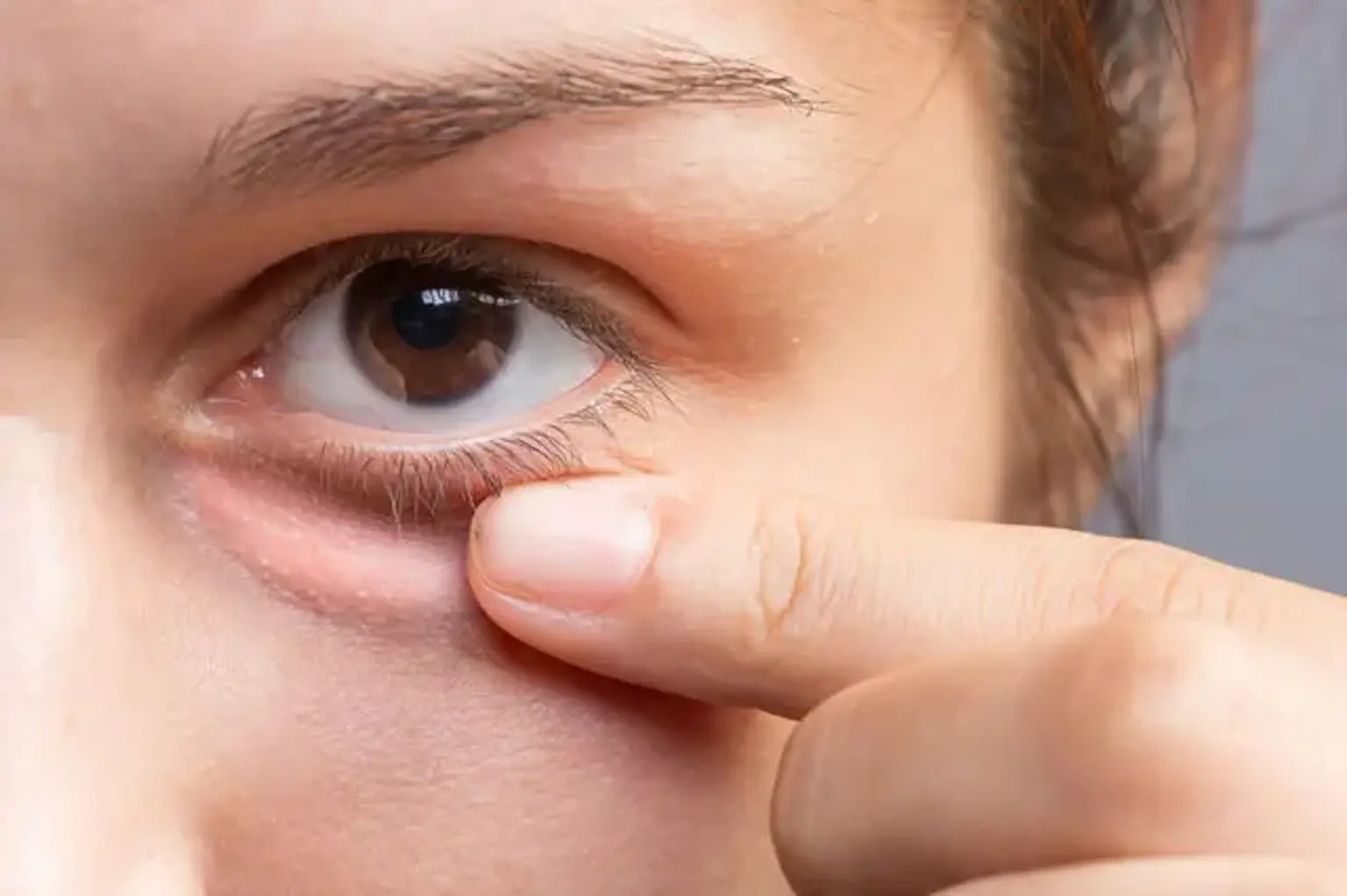 Types of eye tumors