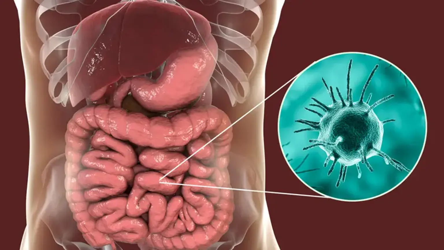 Amebiasis: A Complete Guide to Causes, Symptoms, and Treatment Options