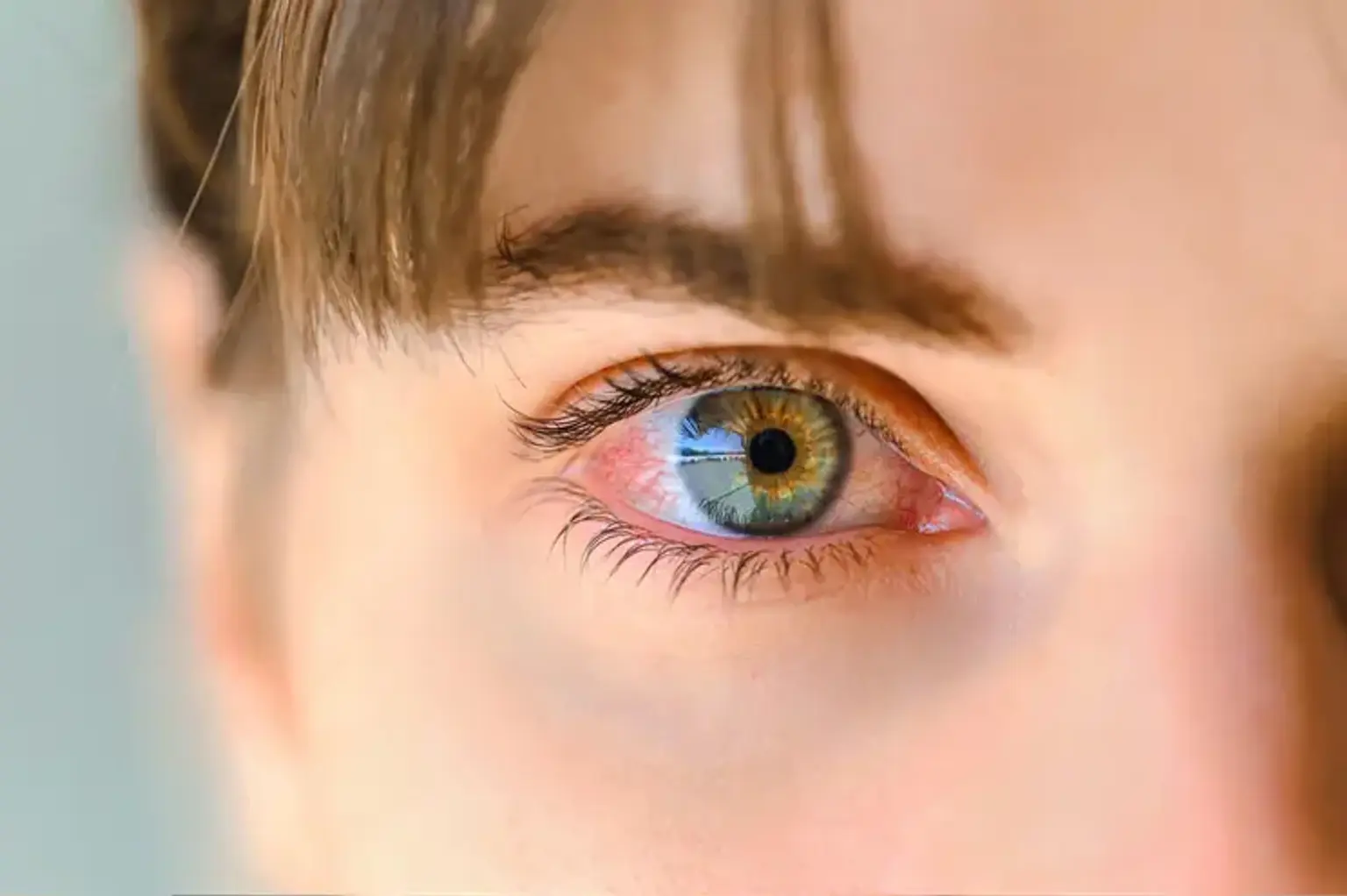 A Comprehensive Guide to Recovery After Uveitis Treatment in Korea