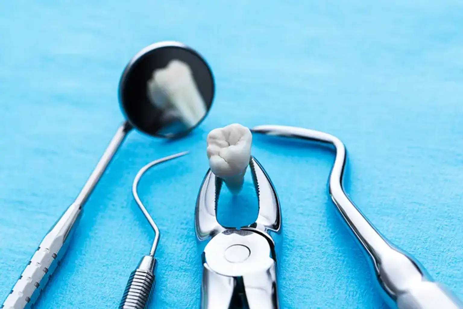 Tooth Removal (Extraction)