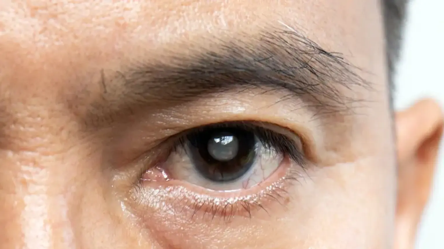 Is Post-Surgical Glaucoma Follow-up in Korea Safe and Effective? A ...