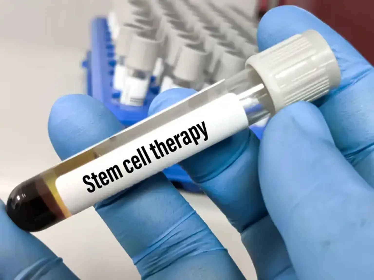 Separating Fact from Fiction: Regenerative Stem Cell Therapy Myths in ...