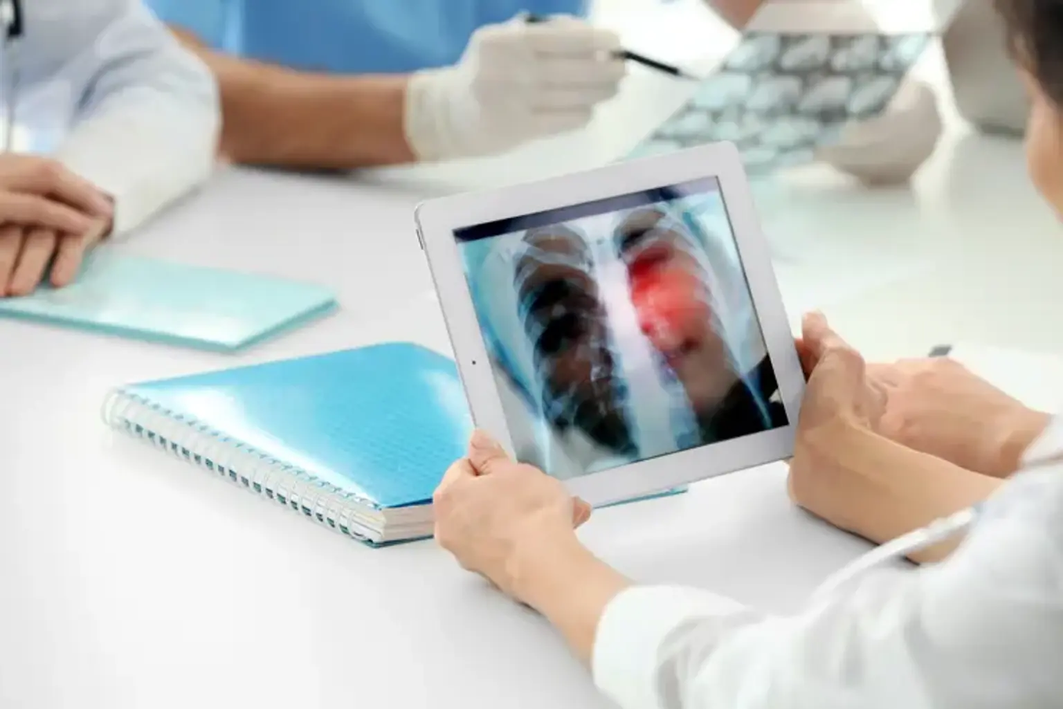How Lung Cancer CT Scans May Reveal Signs of Other Undiagnosed Cancers