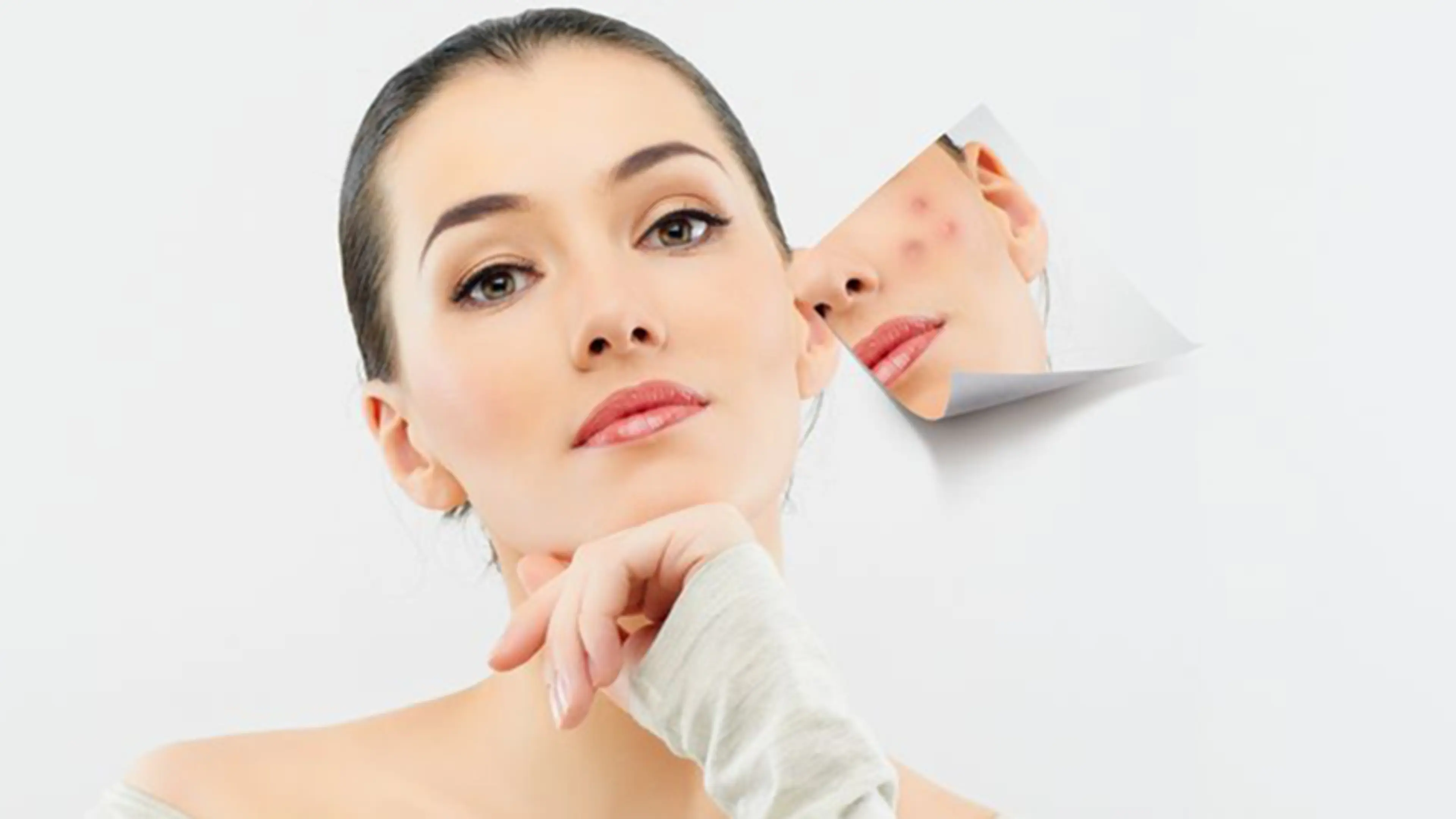 What Is Juvelook and Why Is It Trending Among Skin Experts?