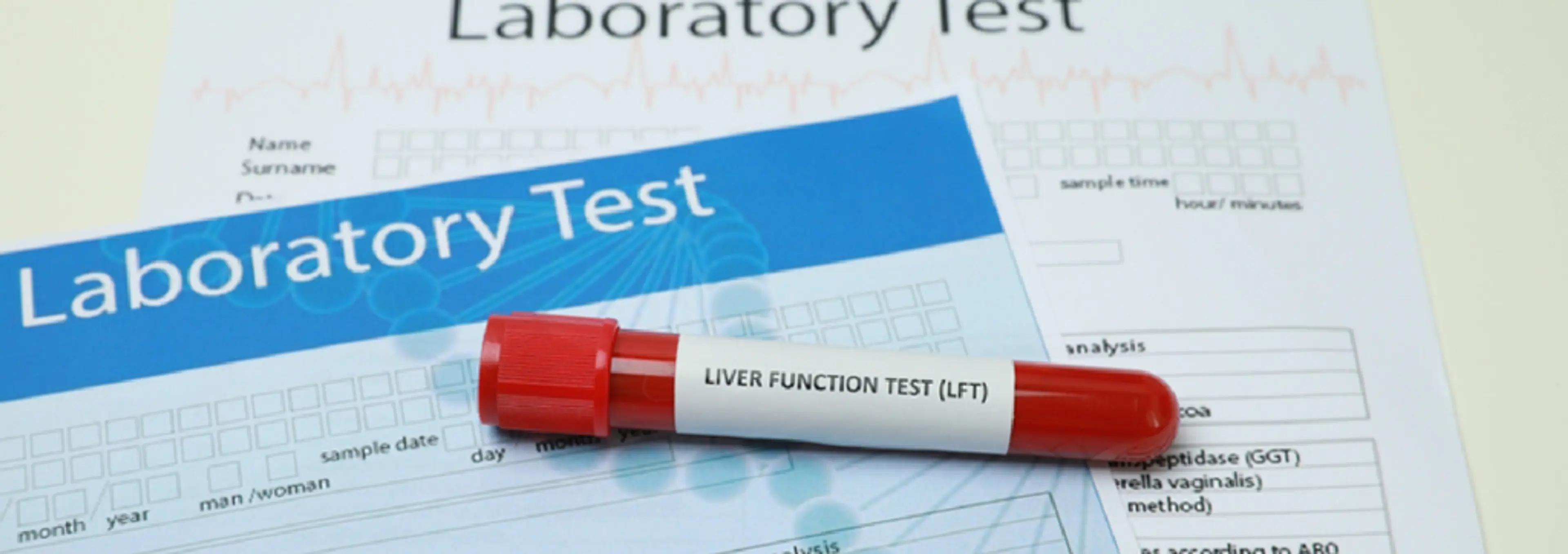 Articles | The Importance of Routine Liver Function Tests – What They ...
