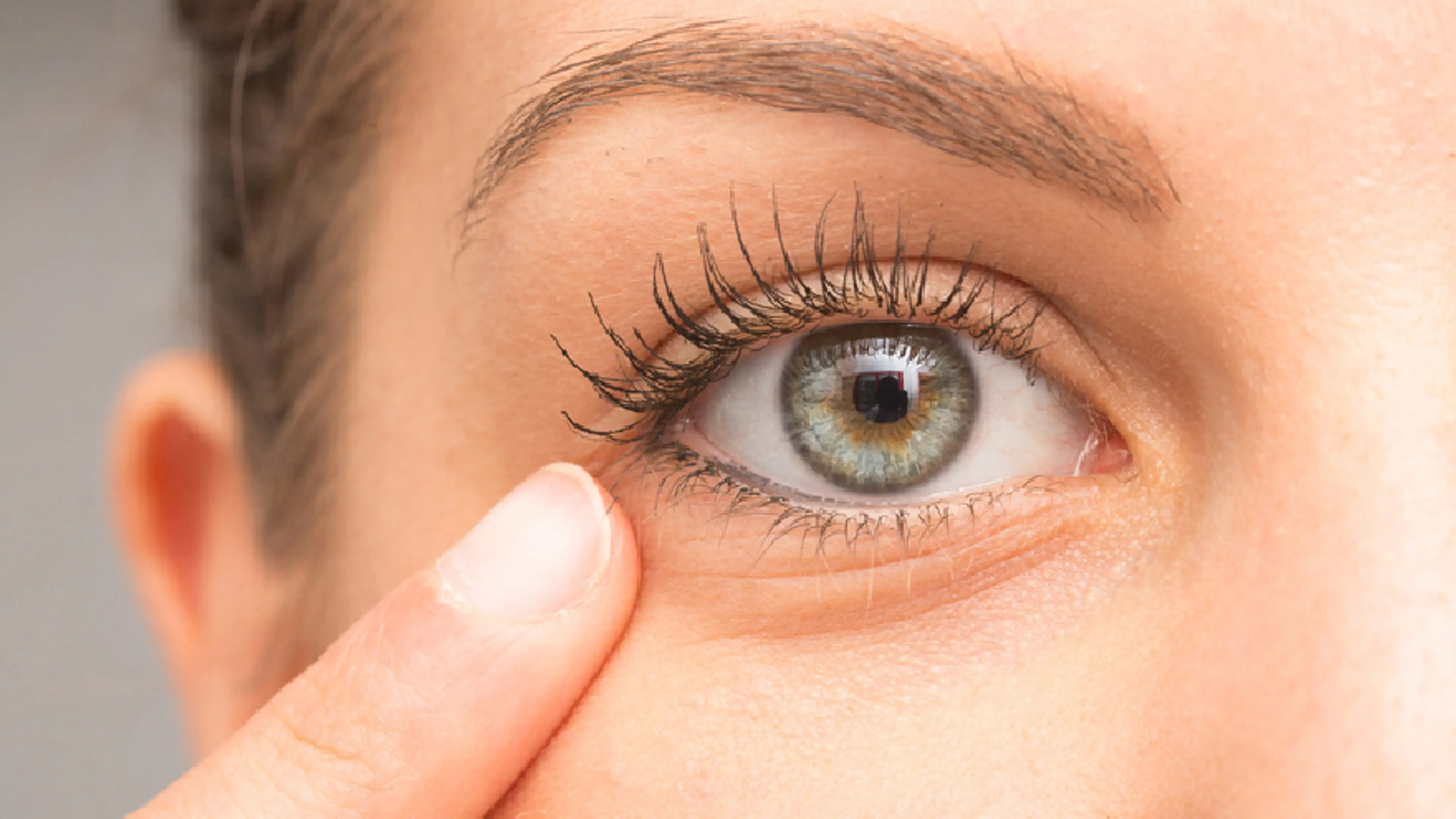 The Benefits of Triple Lower Blepharoplasty for Aging Eyes