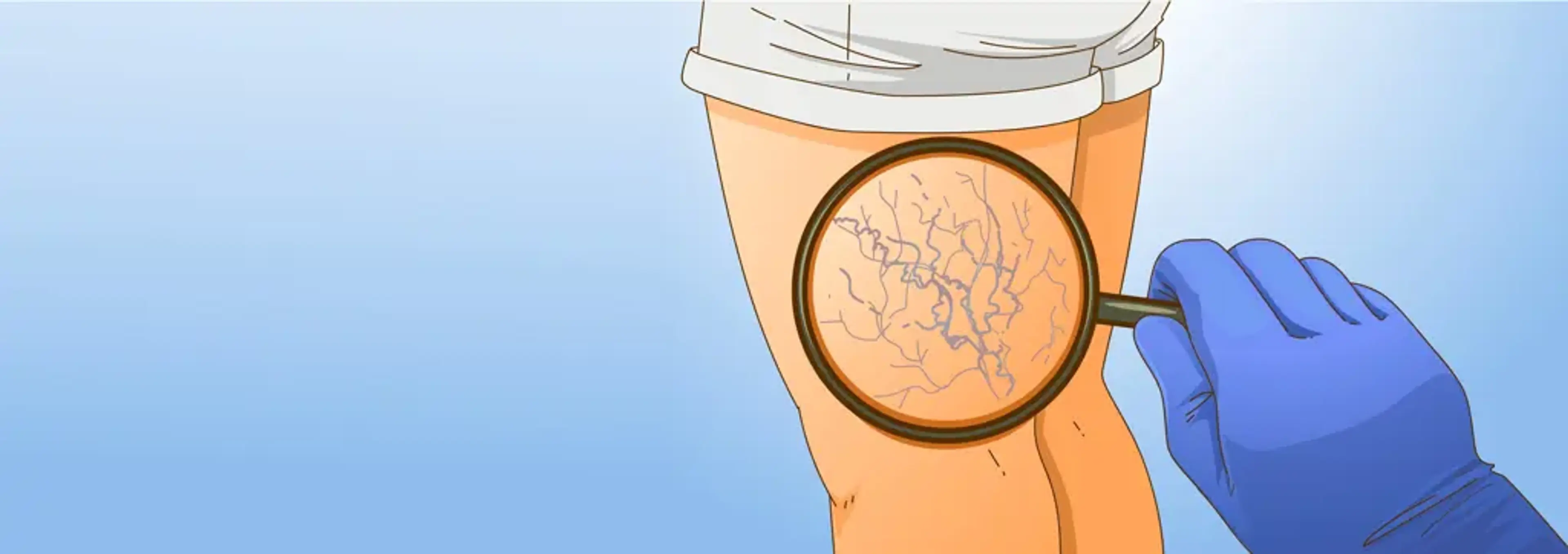 Articles | How Doctors Use Ultrasound to Map Your Vein System